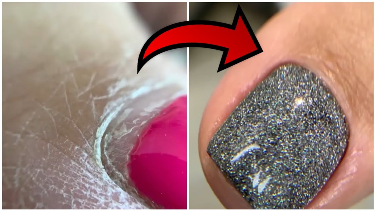 Most Satisfying Pedicure Transformation 😱 best nail polish for toes ...
