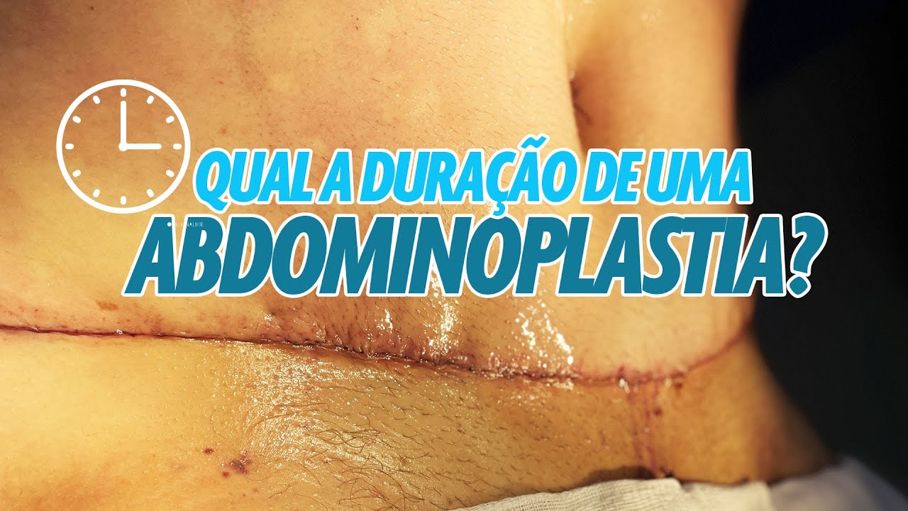 QUAL A DURAÇÃO DE UMA ABDOMINOPLASTIA? CIRURGIA PLÁSTICA - YouTube