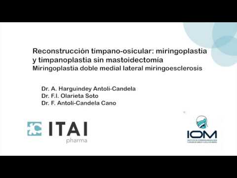 Miringoplastia doble medial lateral miringoesclerosis - YouTube