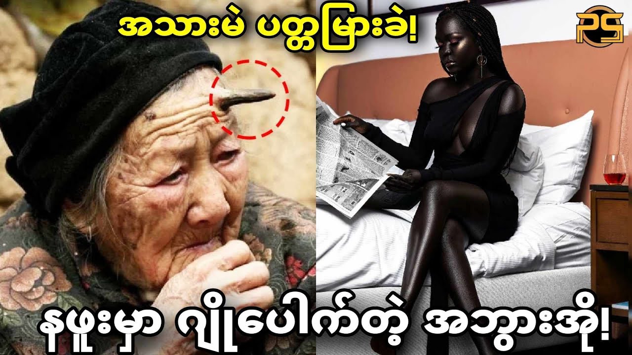 ဒီအဘွားအိုက နှစ် ၃၀ ကြာ နဖူးမှာ ဂျိုပေါက်ခဲ့တယ်😱😱 Youtube