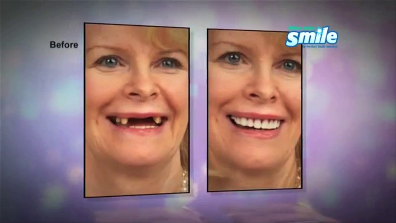 You Got Some Gross Teeth In Your Face - YouTube