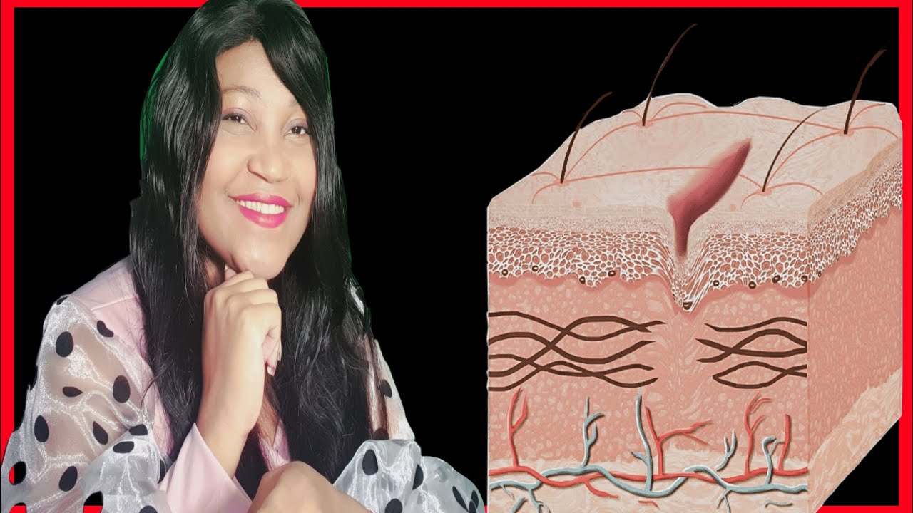 Enlevez complètement les vergetures avec cette astuce - YouTube