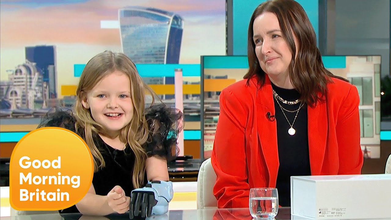 8-Year-Old Alexia Robinson’s First Christmas With A Bionic Hand | Good ...