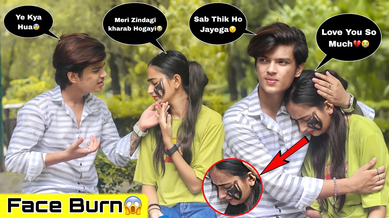 Face Burn Prank || Prank On Boyfriend (Gone Extremely Wrong😱 ...