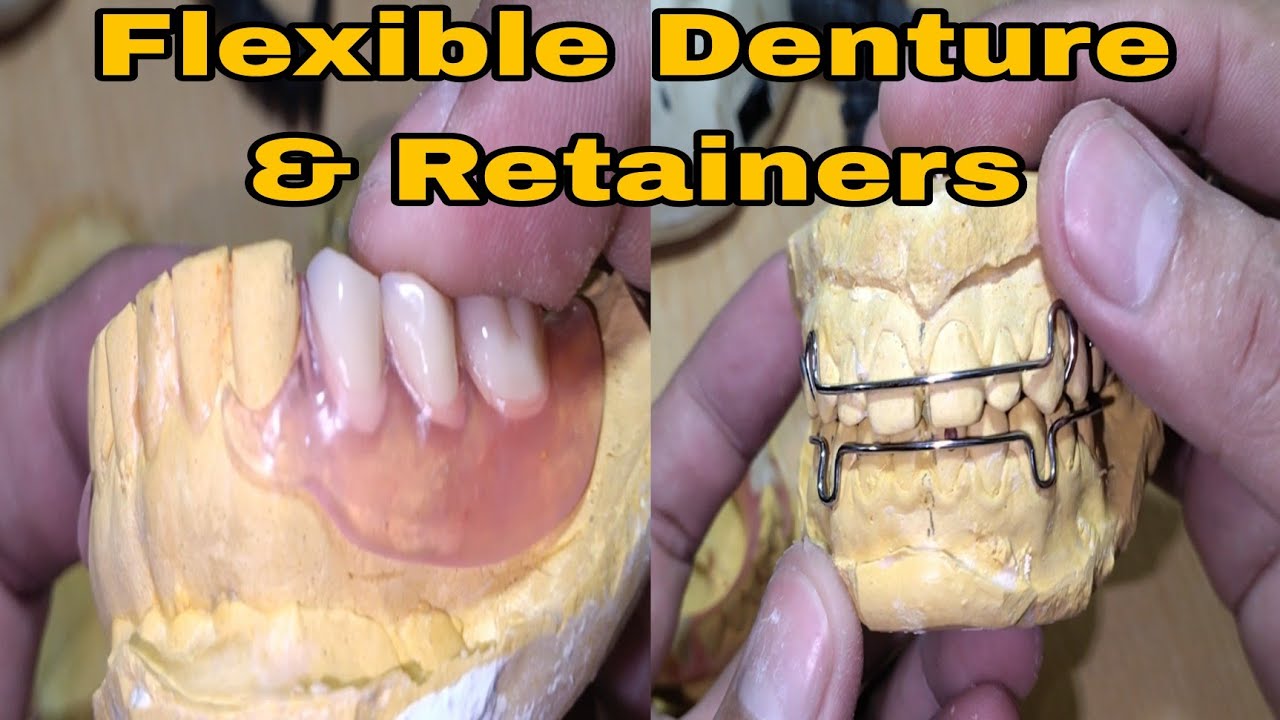 Lower Flexible Denture and Upper and Lower Retainers. - YouTube