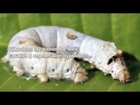What Are Symptoms Of Clogged Arteries and How To Remove Clogged ...