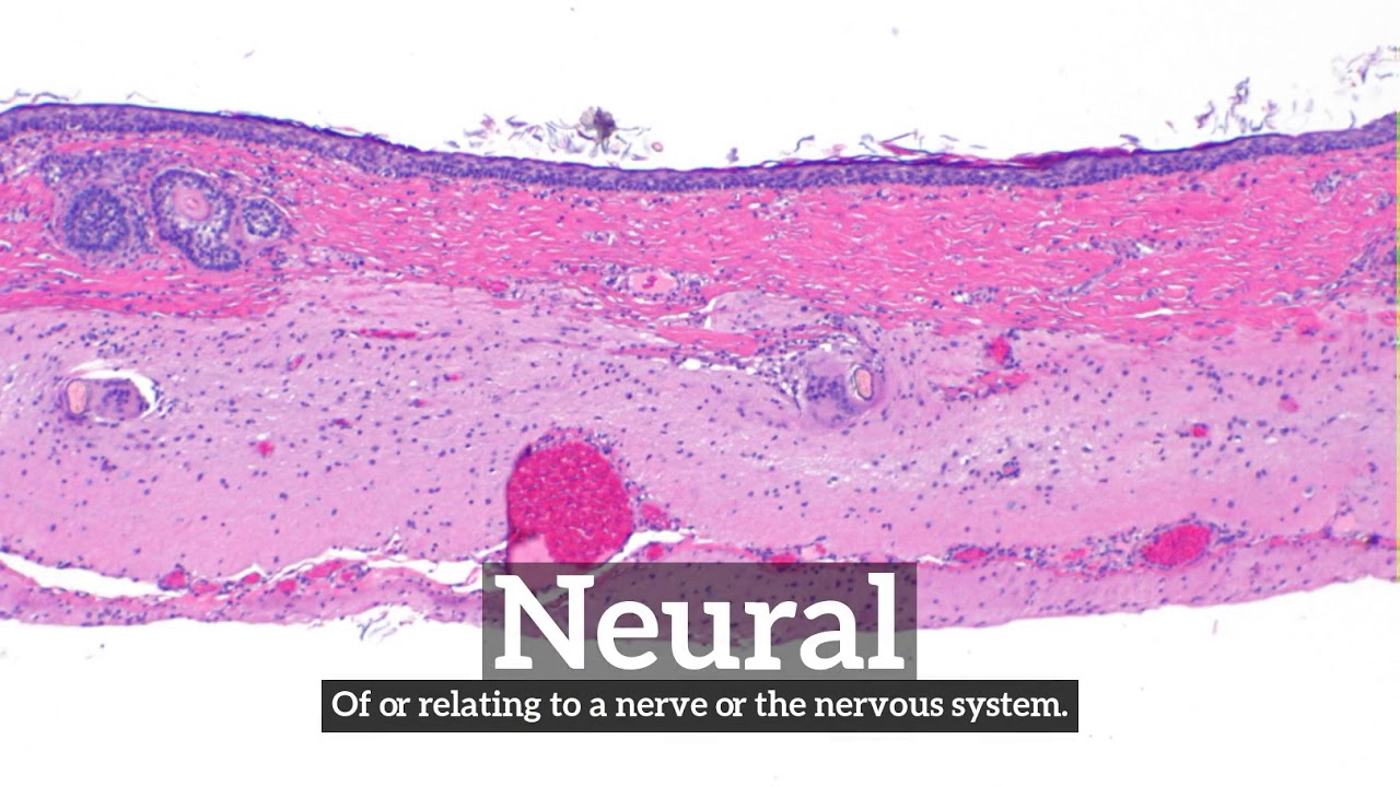 What is Neural? | How Does Neural Look? | How to Say Neural in English ...