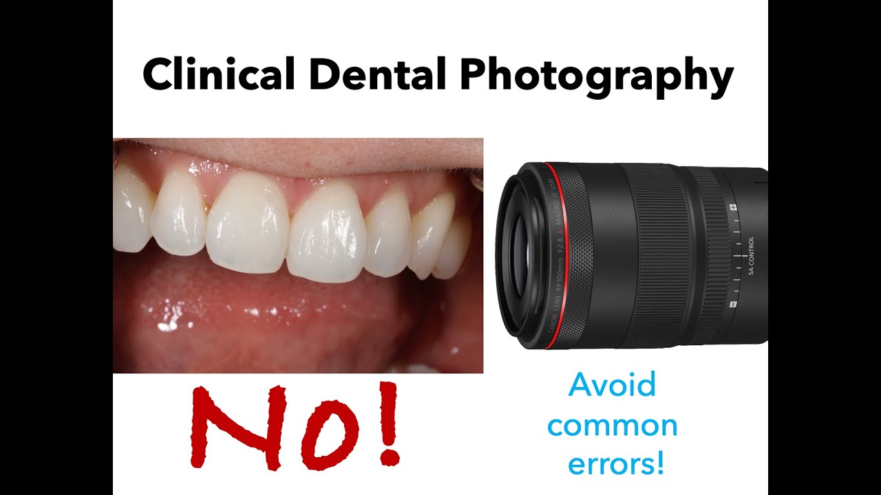 Dental Photography: 3 Tips for Excellent Anterior Images HD 1080p - YouTube