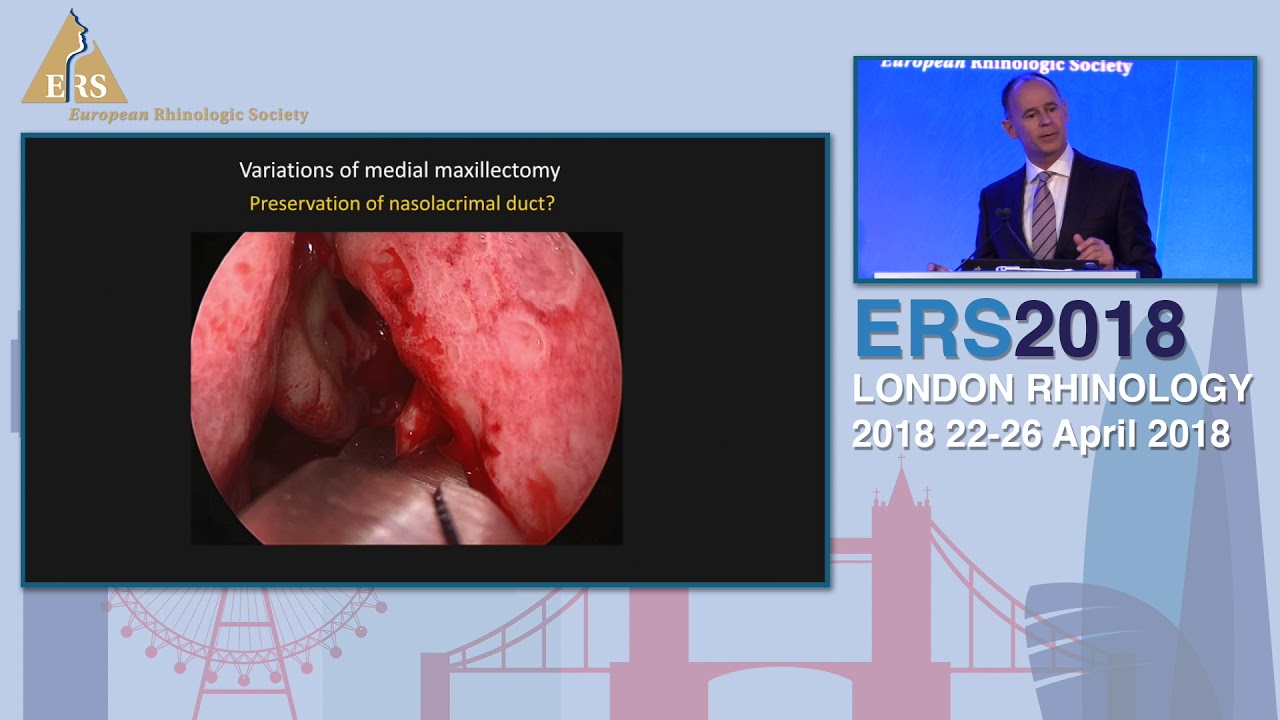 ERS London 2018, H Briner, Indications For Medial Maxillectomy - YouTube