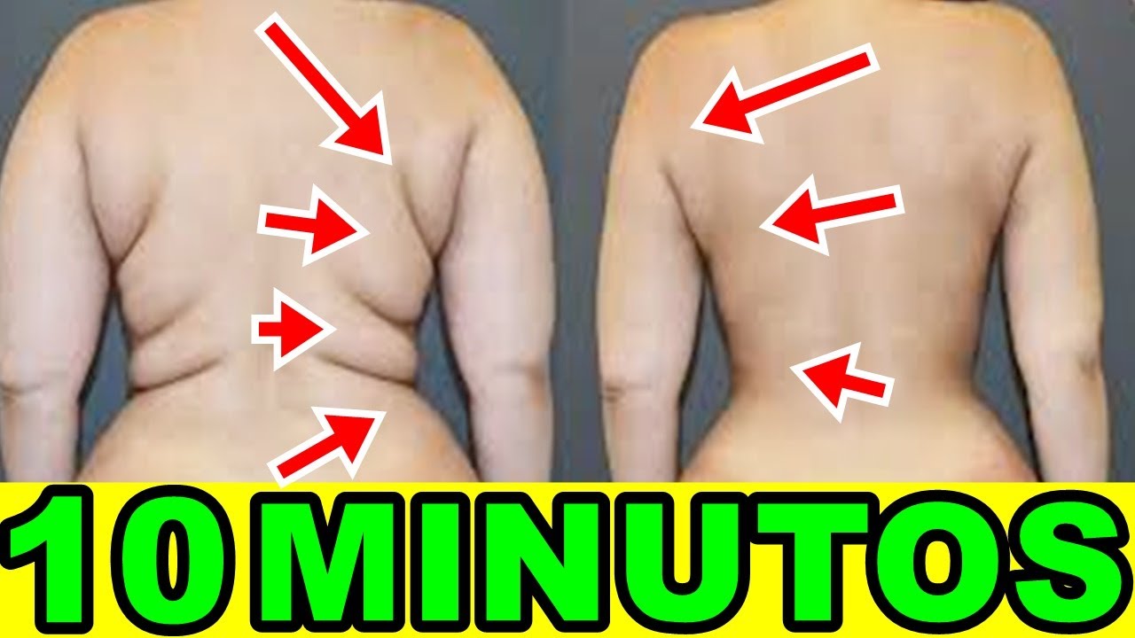 VocÊ NÃo Consegue Tirar A Gordura Das Costas Experimente Fazer Este