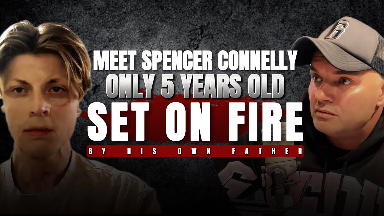 MEET SPENCER CONNELLY ONLY AT 5 YEARS OLD SET ON FIRE BY HIS OWN FATHER ...
