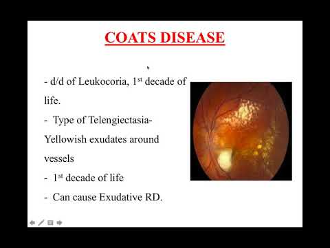 coats disease - YouTube