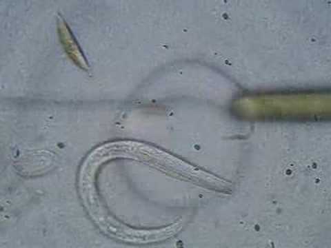 A Marine Nematode Roundworm - YouTube