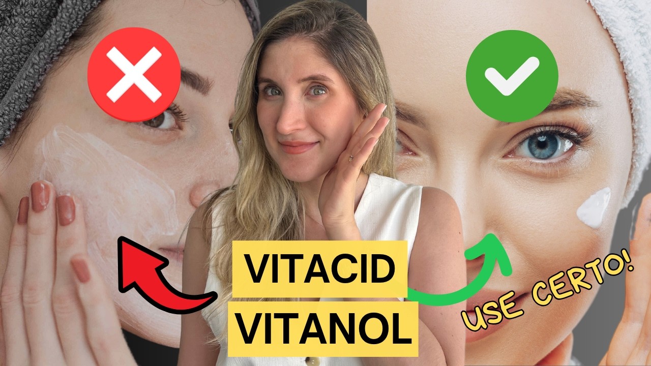 Jeito CERTO de usar Vitacid/Vitanol/Belpele/Epiduo- Guia Definitivo ...