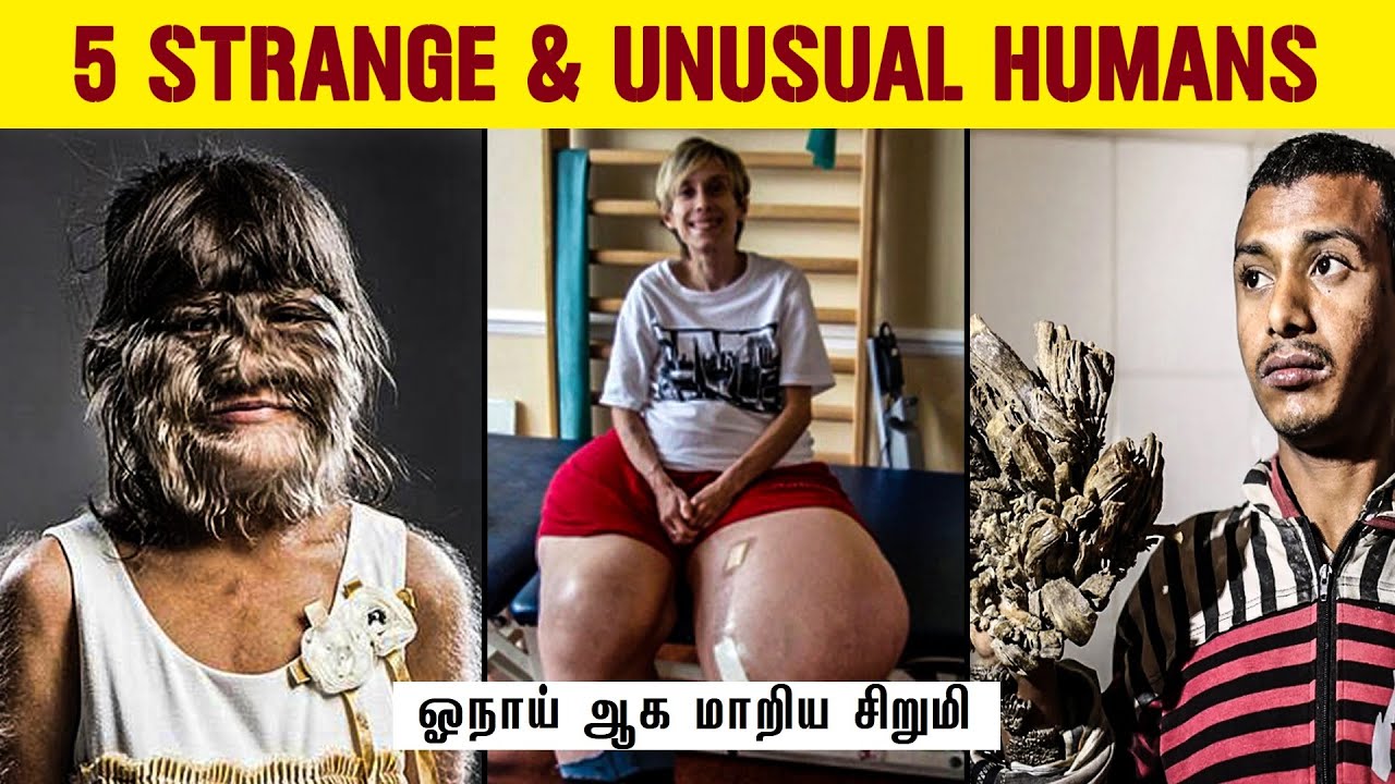 5 விநோதமான மனிதர்கள் | The most Unusual and Strange Humans in the world ...
