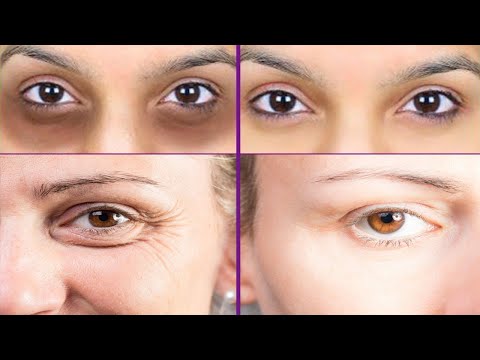 3 Günde Göz Çevresi Kırışıklık Kaz Ayaklarından Ve Göz Altı Morluklardan SONSUZA DEK KURTUL - Bakım