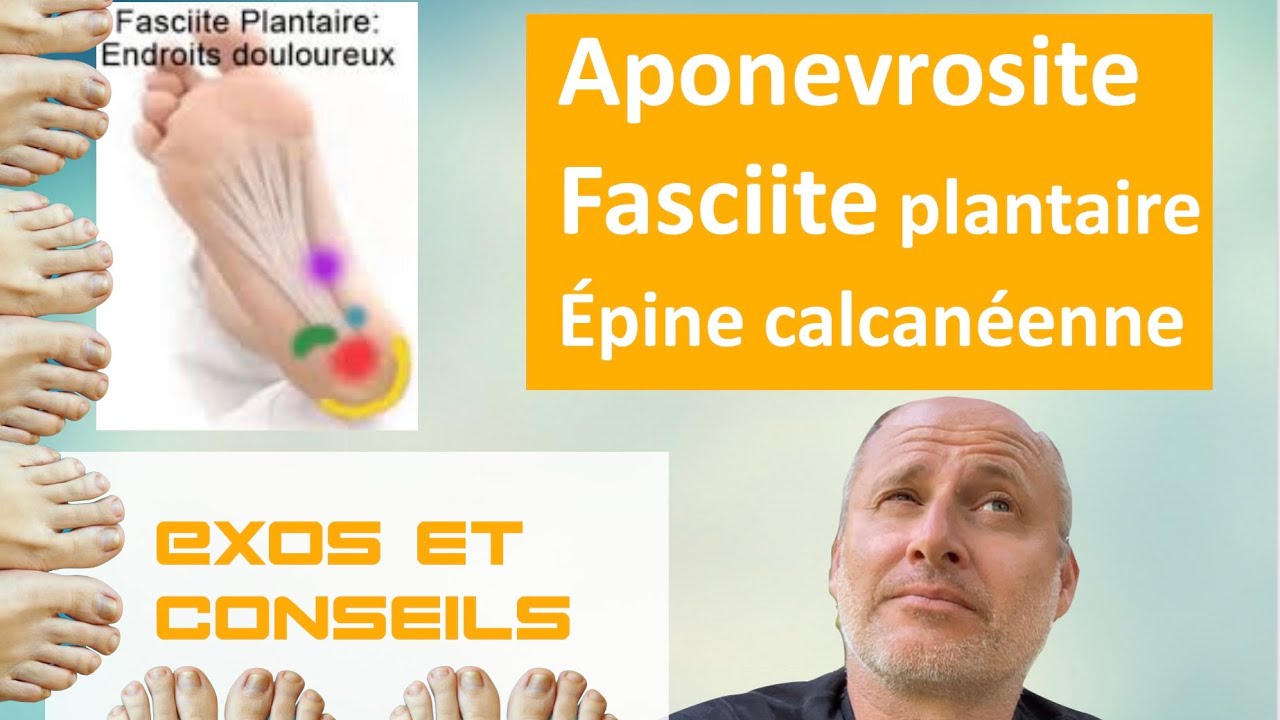 Fasciite plantaire, aponévrosite plantaire, épine calcanéenne - YouTube