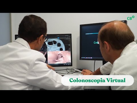 Colonoscopia Virtual: prevención y diagnóstico precoz del cáncer de ...