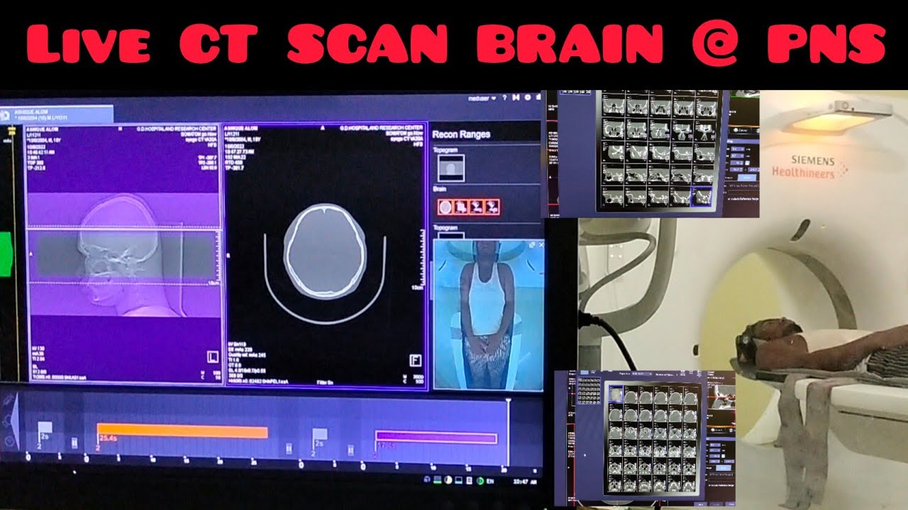 CT SOMATOM go.BRAIN/PNS,ct scan brain/pns # CT SOMATOM. go ,#siemens ...