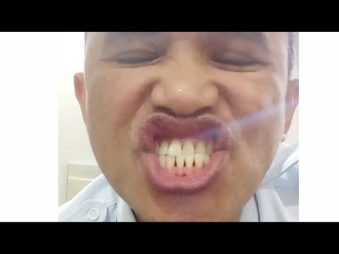 Ang tamang pag toothbrush sa ngipon #jessicasoho# ...