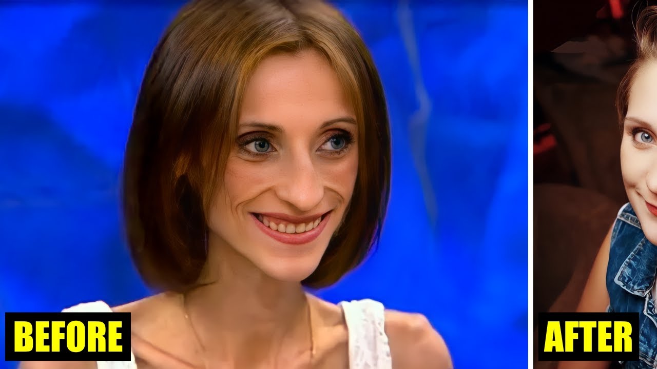 Do you Remember HER? At 19 she Weighed just 26 kg! This is how she Looks Years later - YouTube