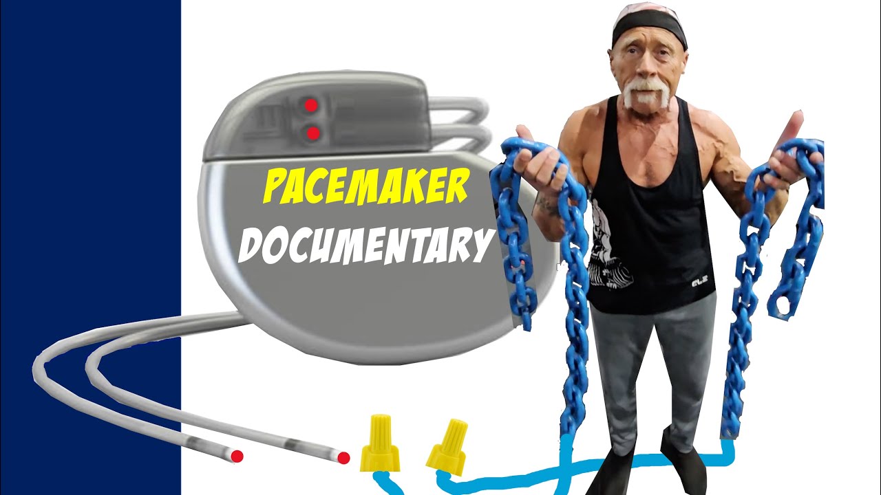 Pacemaker Documentary: How to Live w/a Pacemaker 2024 - YouTube