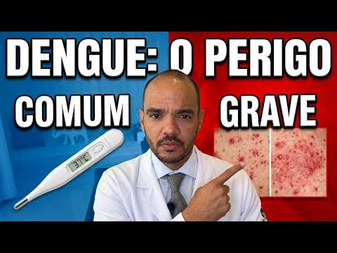 🚨 ALERTA! 4 SINTOMAS DA DENGUE HEMORRÁGICA ( GRAVE)