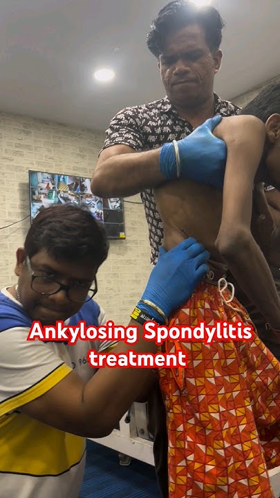 Chiropractic treatment for Ankylosing Spondylitis #chiropractor - YouTube