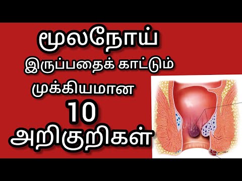 மூலம் நோய் அறிகுறிகள் || reason for piles || உள் மூலம் நோய் அறிகுறிகள் || health and home tips