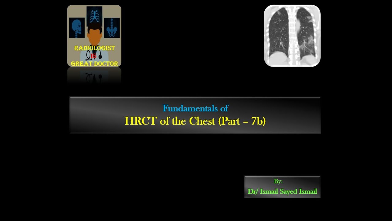 HRCT chest for Radiology Residents - Part 7b - Mosaic Pattern - YouTube