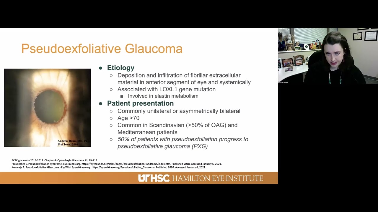 Lecture: Pigmentary and Pseudoexfoliative Glaucoma - YouTube
