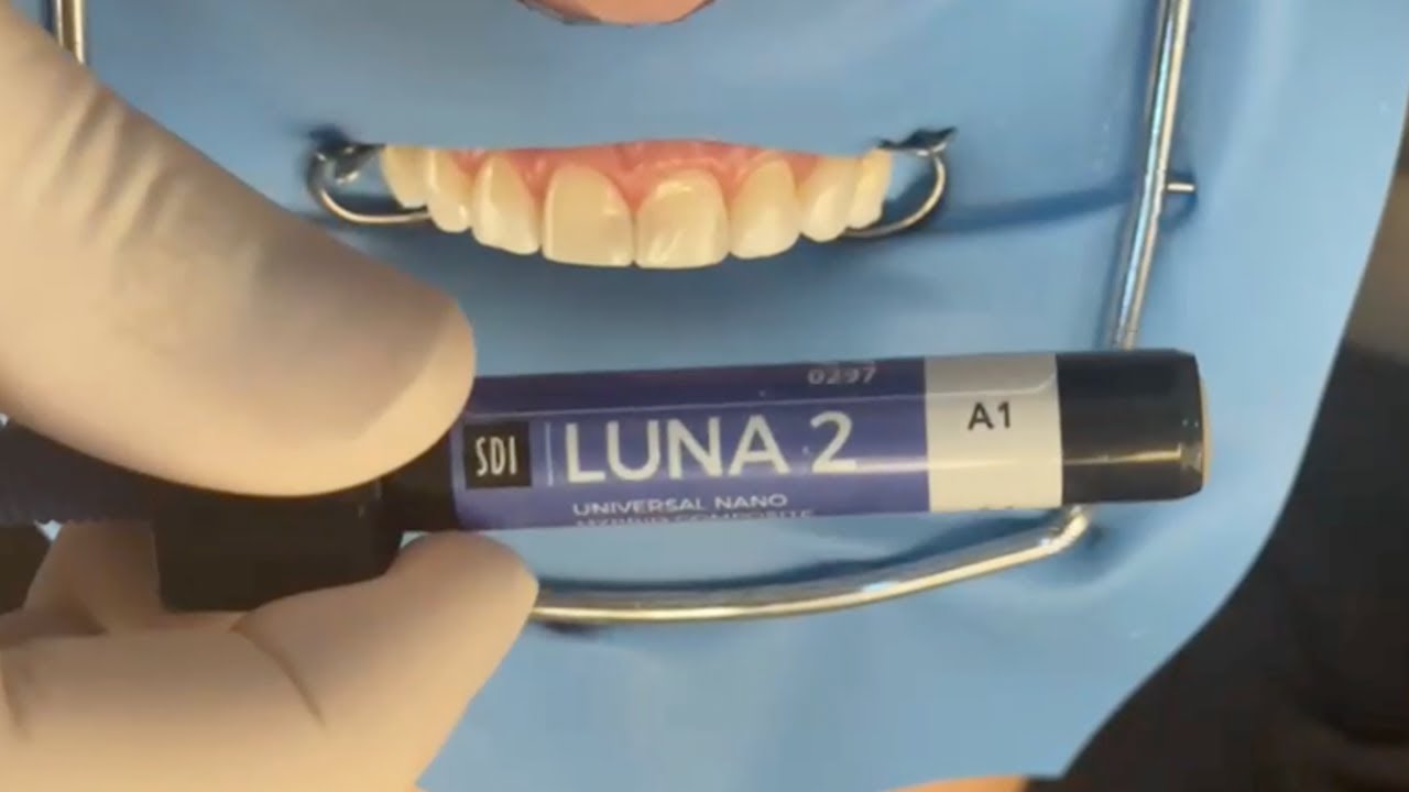 Utilização clínica da Resina Luna 2 e Luna Flow | Prof. Renato Voss ...