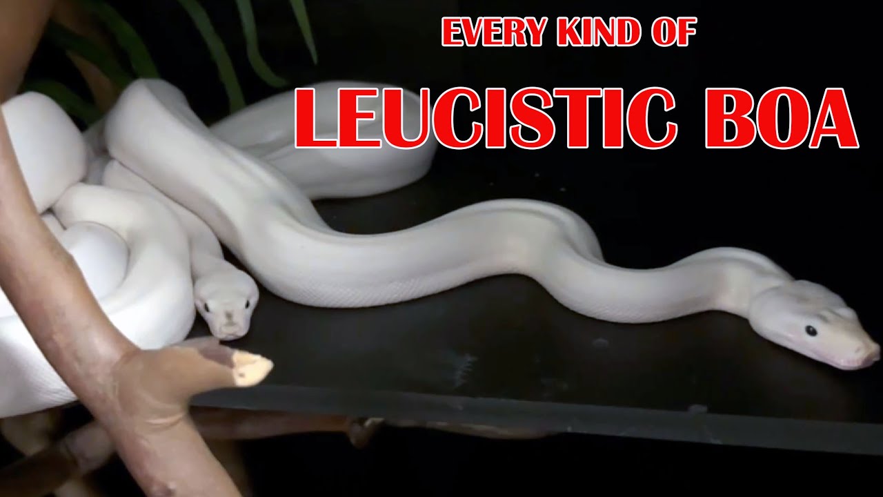 Leucistic Human