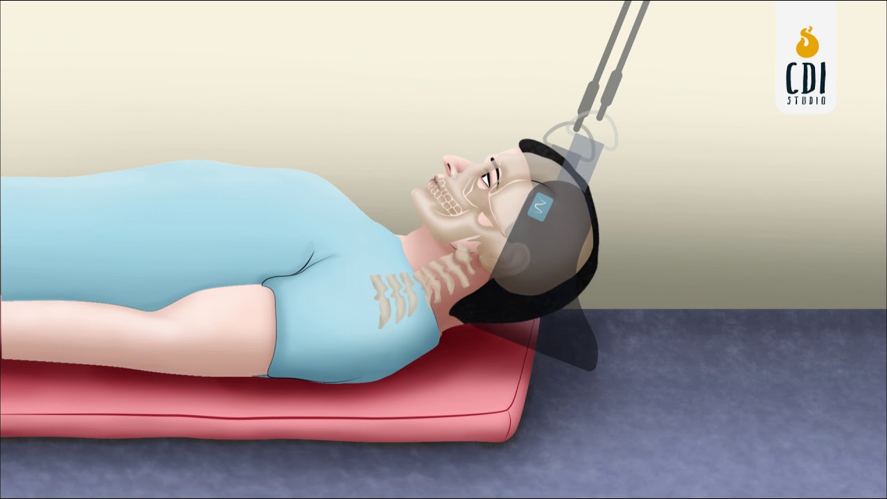 The Neck Hammock: 2D Animation of Neck Pain Relief - YouTube