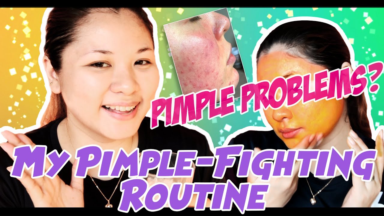 My Pimple-fighting Routine (Bonus Face-slimming Technique) - YouTube
