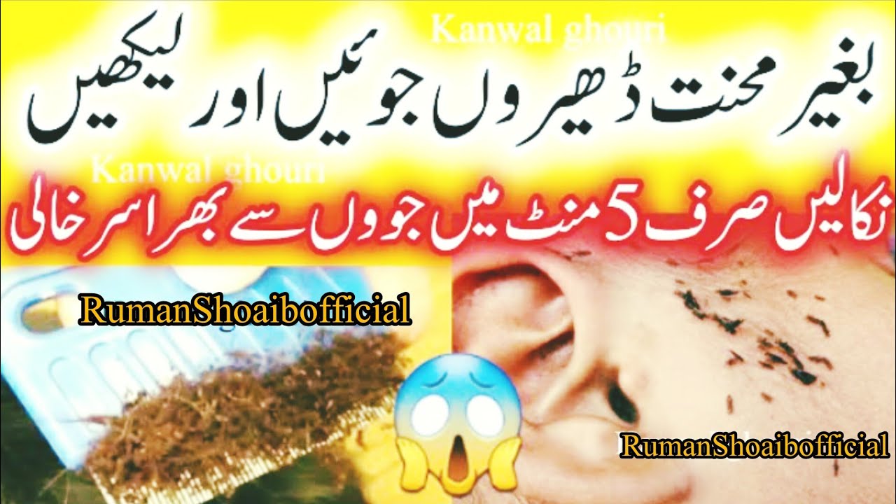 Anti Lice Treatment At Home | Juain Khatam Karne Ka Tarika || free of ...