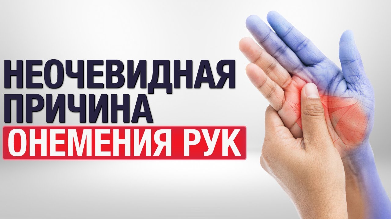 ОНЕМЕНИЕ конечностей ОПАСНО для здоровья!? / Как избавиться от ОНЕМЕНИЯ ...