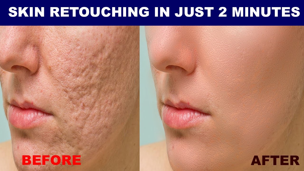How to Retouch Skin|High - End Skin Retouching Photoshop Tutorial in ...