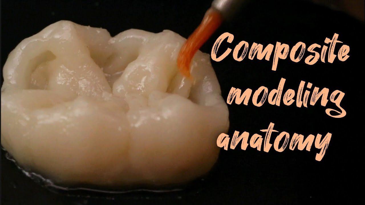 Indirect composite restoration of tooth anatomy.Composite modeling of ...
