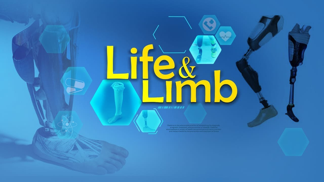 LIFE & LIMB CHARITABLE TRUST | സൗജന്യ കൃത്രിമക്കാല് വിതരണം - YouTube