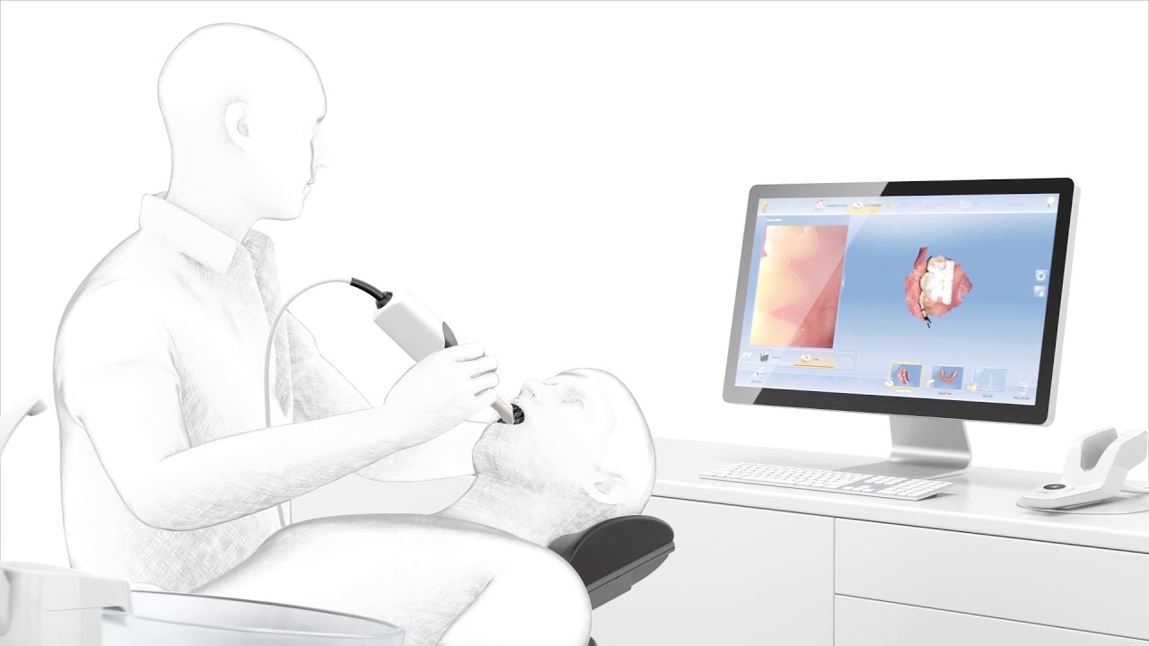 CEREC Omnicam - Scanning made easy | Dentsply Sirona - YouTube