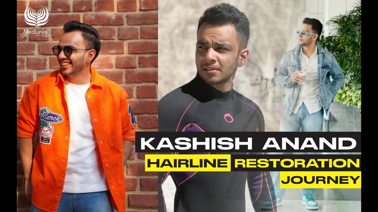 Kashish Anand's Hair Restoration with India's Best: MedLinks Hair ...
