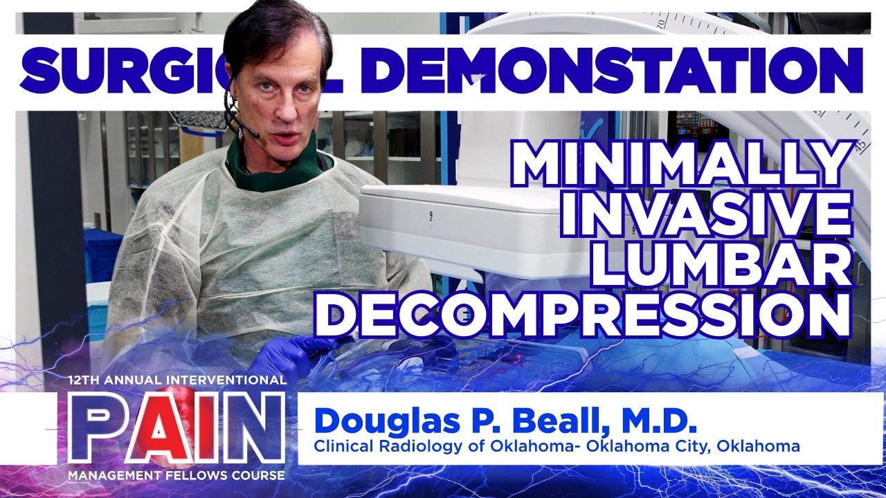 Minimally Invasive Lumbar Decompression - Doug Beall, M.D. - YouTube