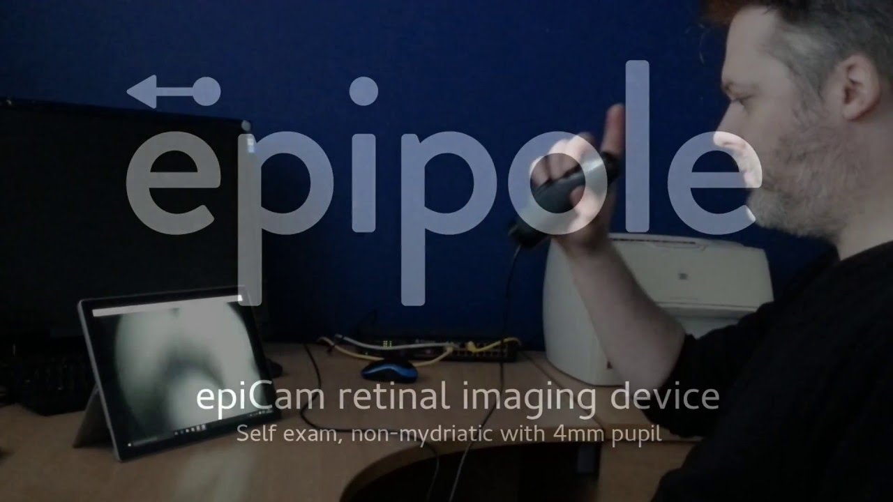 epiCam with Surface Pro 4 - YouTube