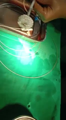 ASD Closure Device #cardiology #cardiologist #heart # ...