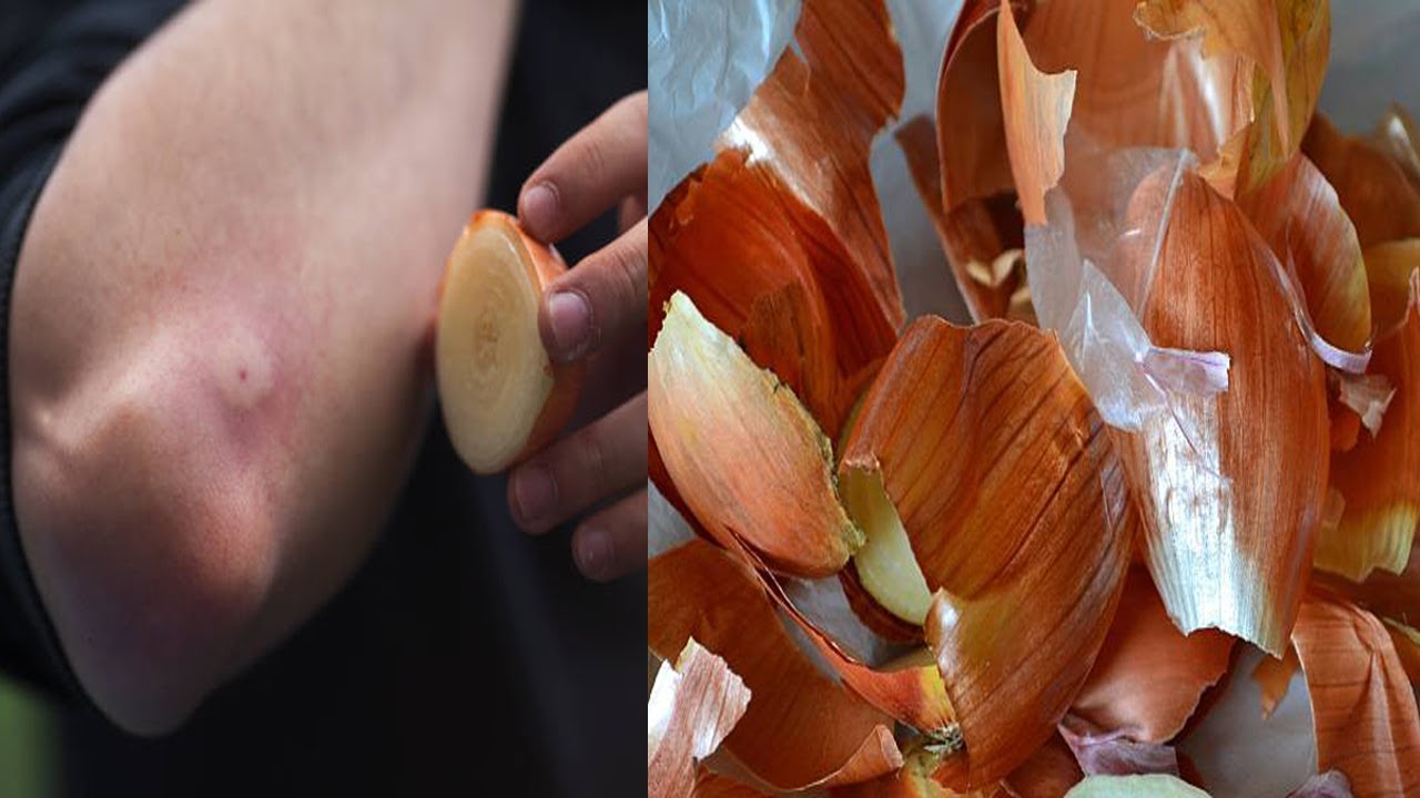Stop throwing onion peels: You'll Never Throw Away Onion Skin After ...