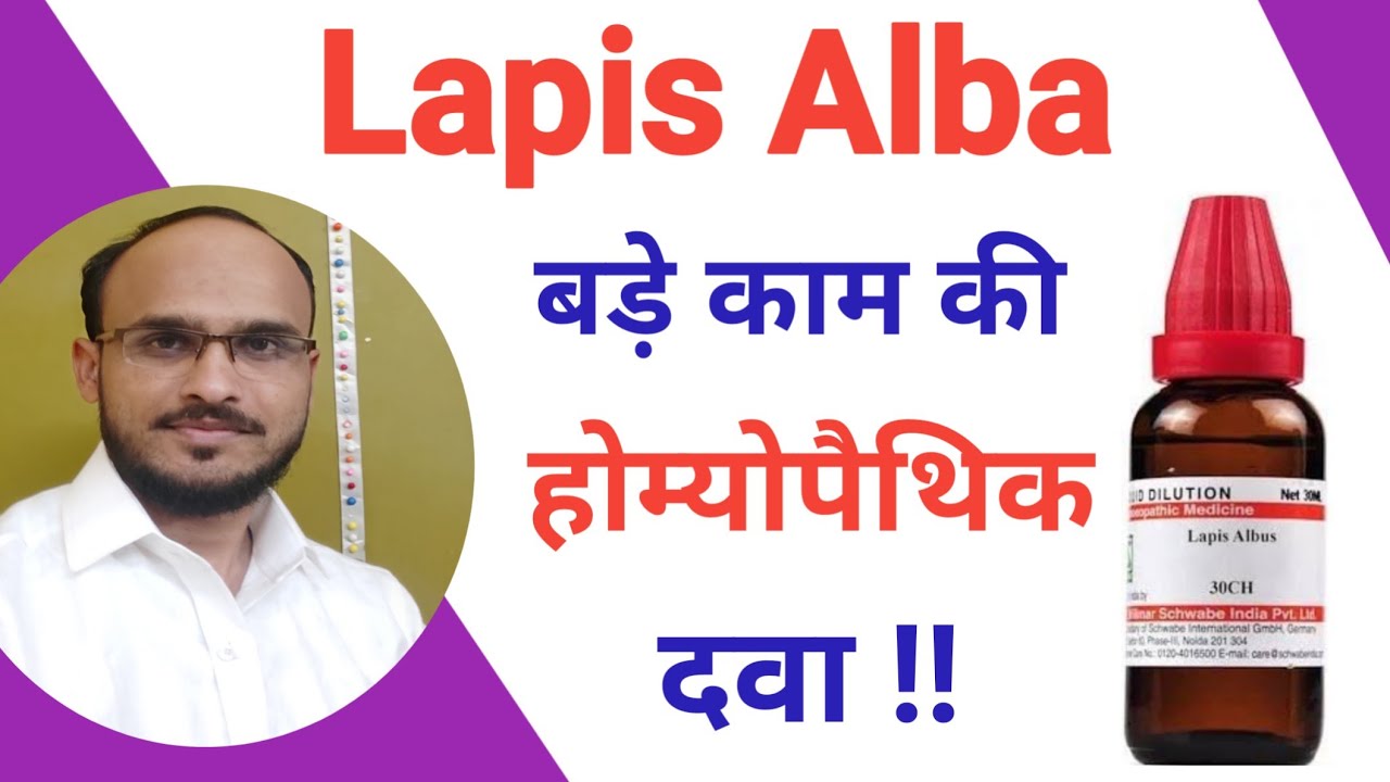 Lapis albus 30 uses | lapis albus 200 uses | lapis albus homeopathy ...