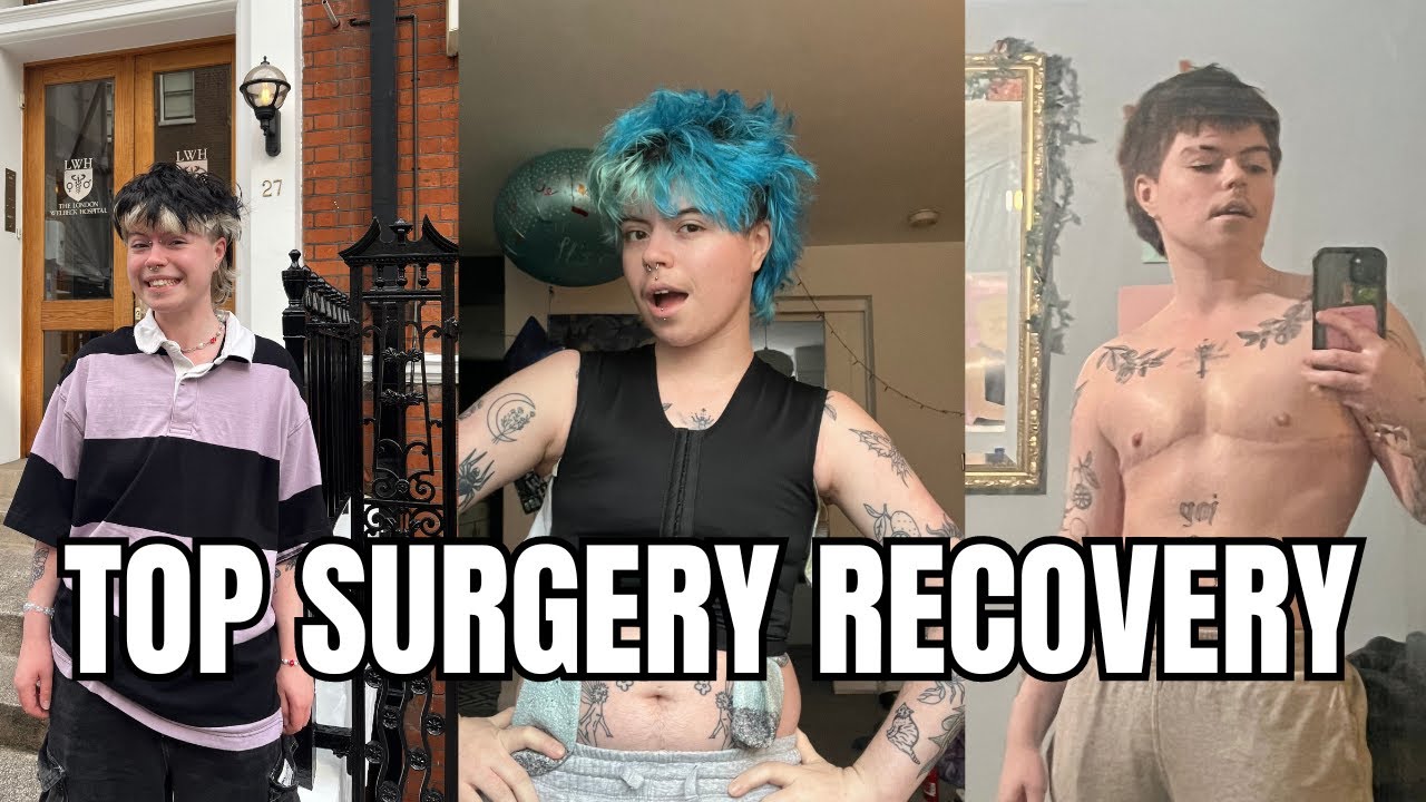 TOP SURGERY RECOVERY / 7+ MONTHS POST OP!! - YouTube