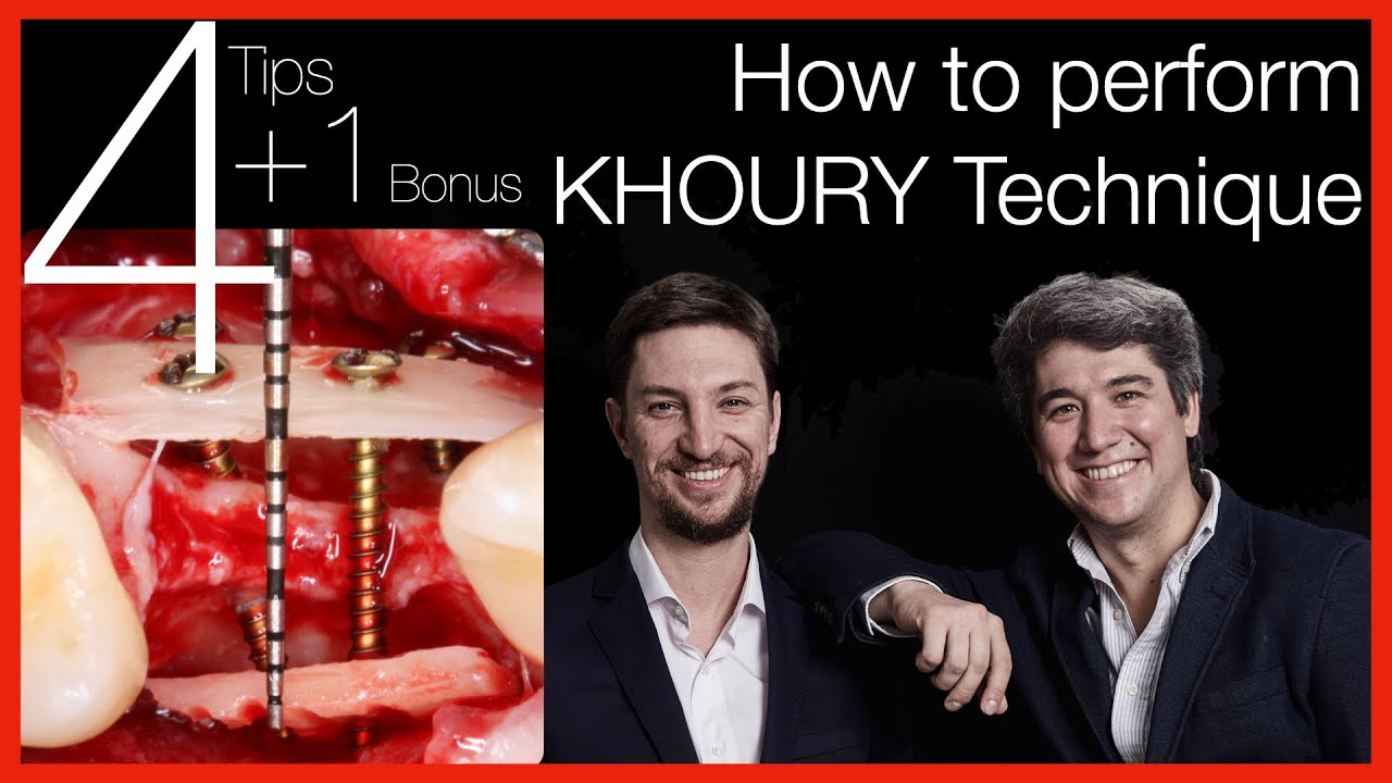 🇺🇸 [KHOURY Technique] ⏪ How to NAIL a BONE Graft 🔥 4 Tips + 1 Extra ...