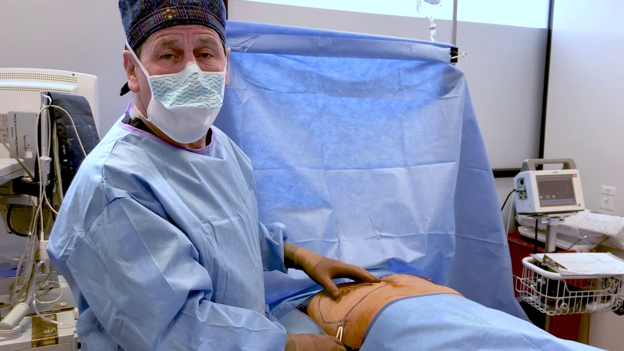 Removal of Granular Material | Gynecomastia | Dr. A. Jabs - YouTube